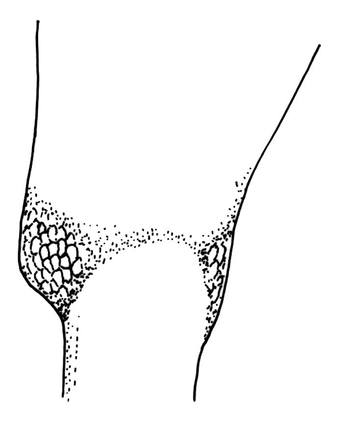 Flora of New Zealand | Taxon Profile | Pulchrinodus inflatus